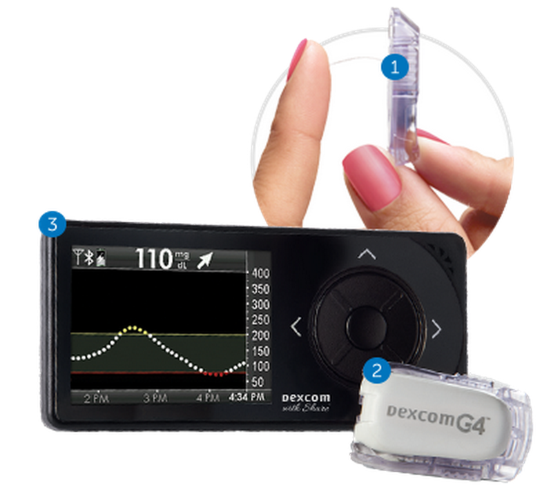 Dexcom sensors will be first to offer continuous glucose monitoring ...