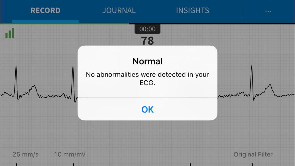 Review: AliveCor Mobile ECG lets an iPhone monitor your heartbeat ...