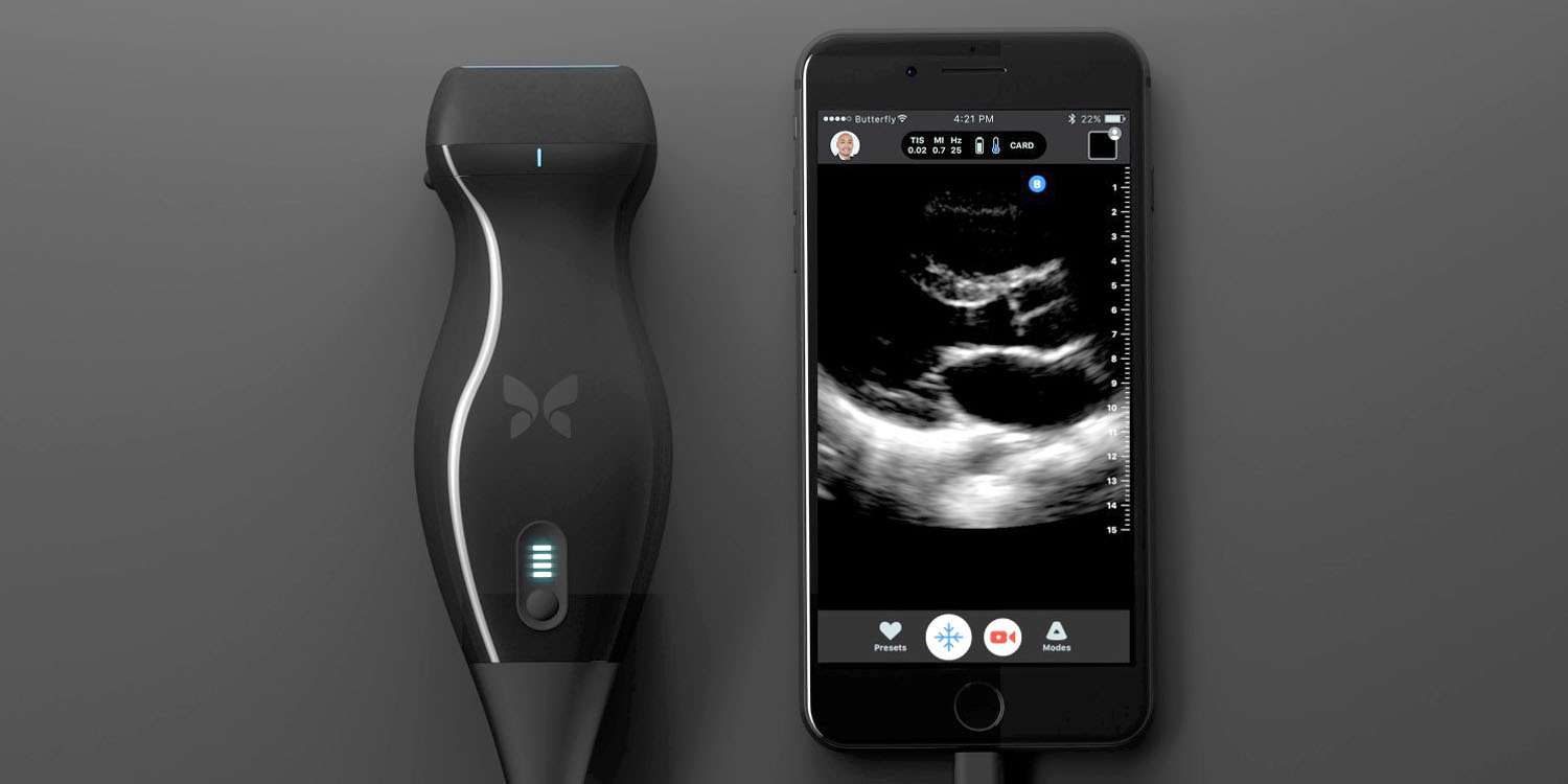 Surgeon uses iPhone-based ultrasound device to diagnose his own cancer ...