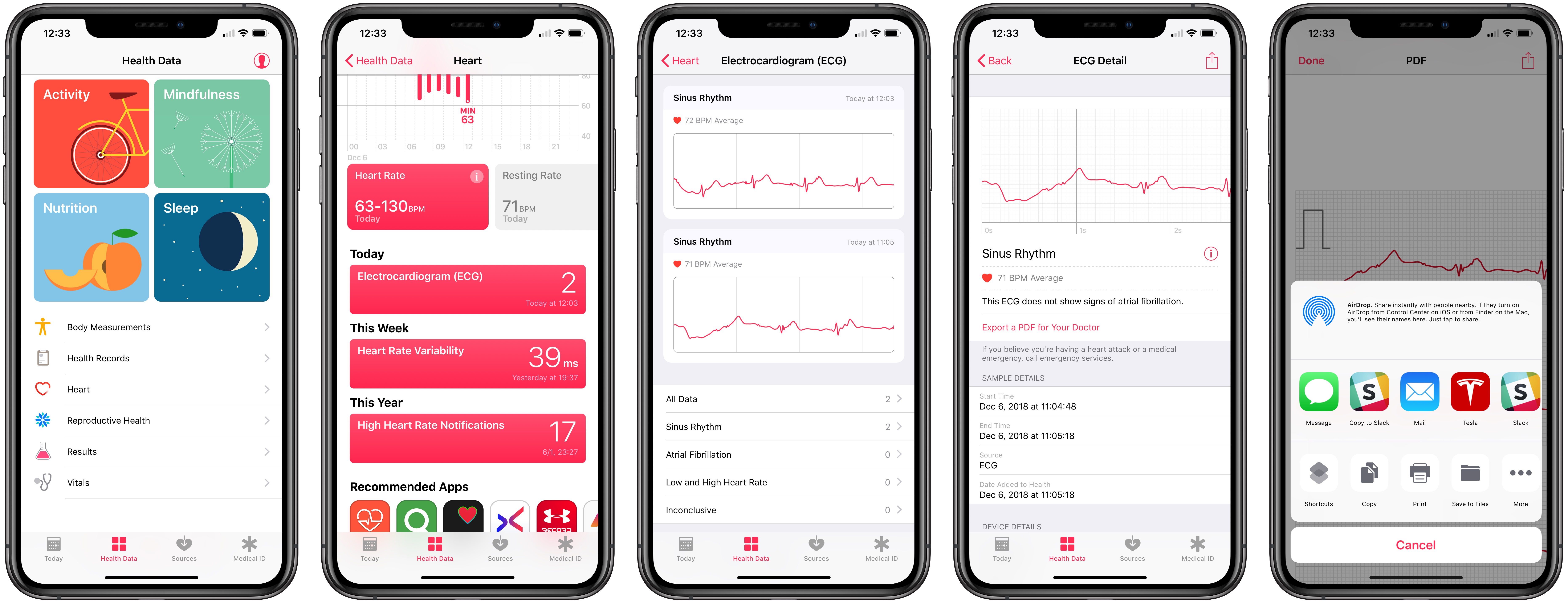 How to share ECG results with your doctor - 9to5Mac