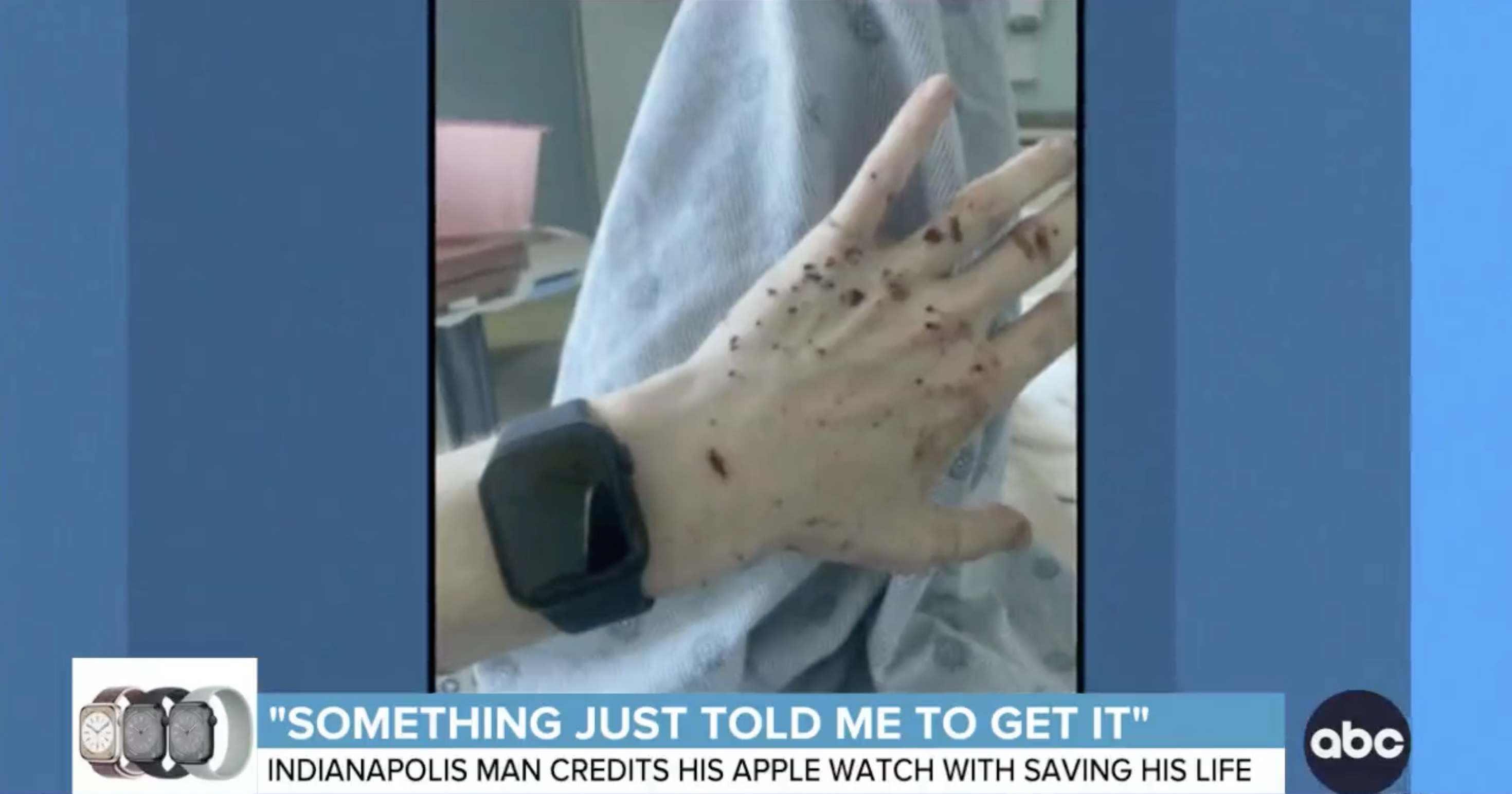 Apple Watch Series 8 Car Crash Detection kicks in and calls for help ...